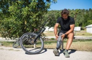 Types of Amputations – Prosthetics Blog